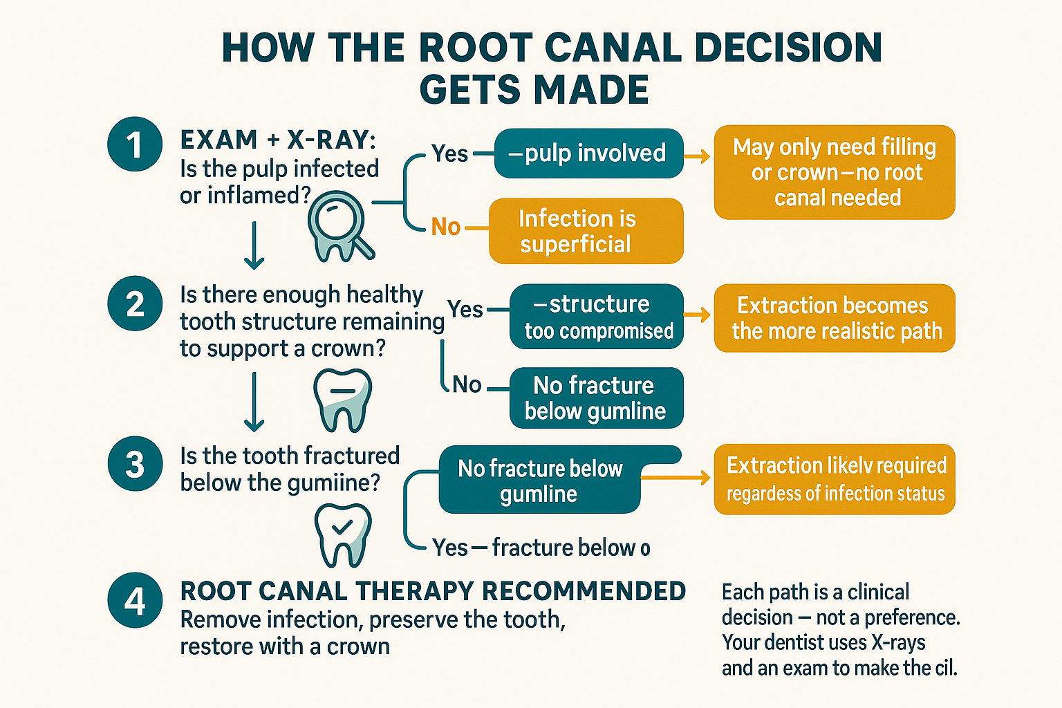 Root Canal or Alternative? How the Decision Gets Made